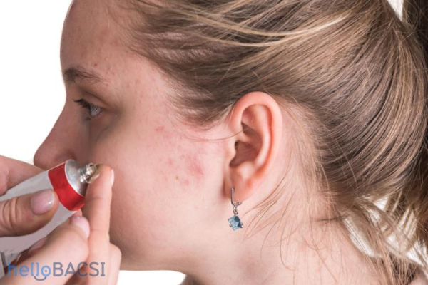 Locacid • Hello Bacsi