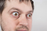 L i M t L G Tri u Ch ng Nguy n Nh n V i u Tr Hello Bacsi