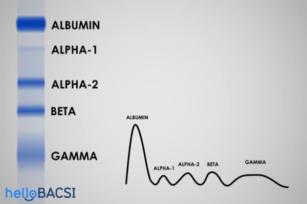 Tìm hiểu Alpha 2 globulin là gì và tác dụng của nó trong cơ thể