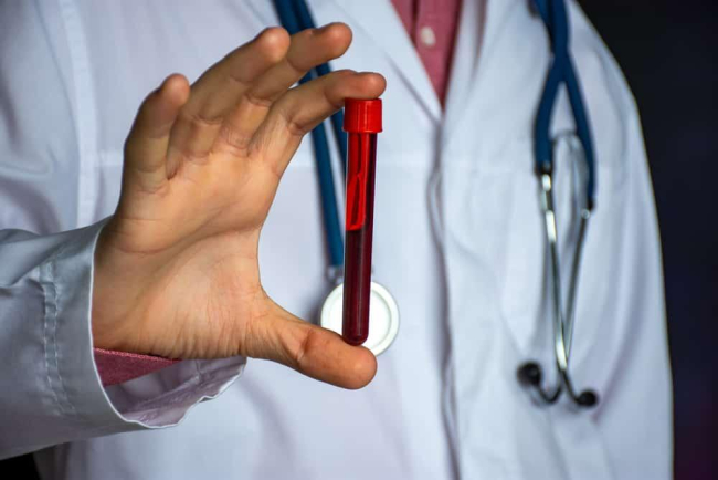 Hct là gì? xét nghiệm chỉ số hct trong máu và những điều bạn cần