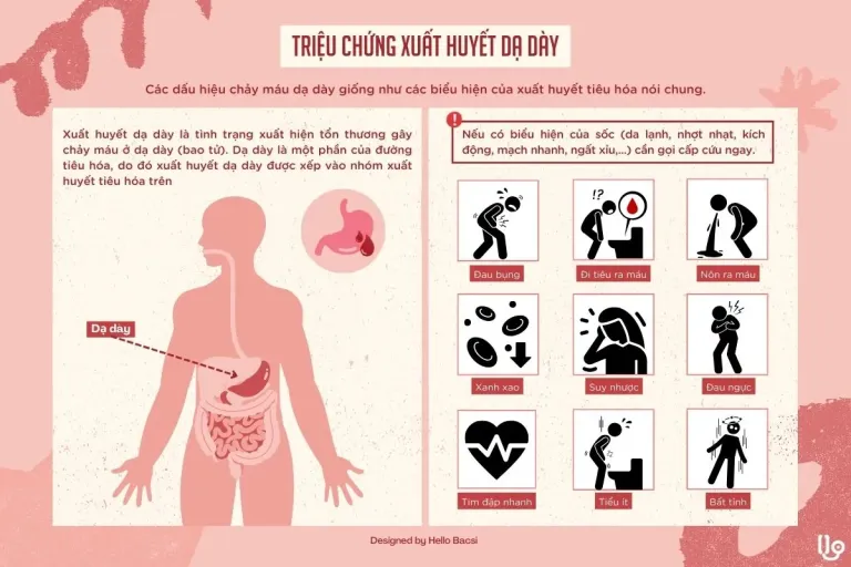 Xuất huyết dạ dày: triệu chứng, nguyên nhân và cách điều trị