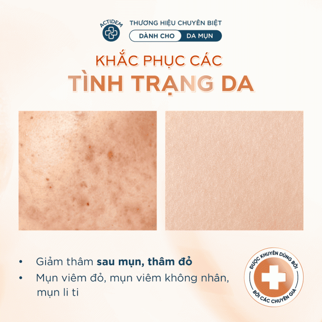 Gel trị mụn mờ thâm Actidem Derma Extra Gel • Hello Bacsi