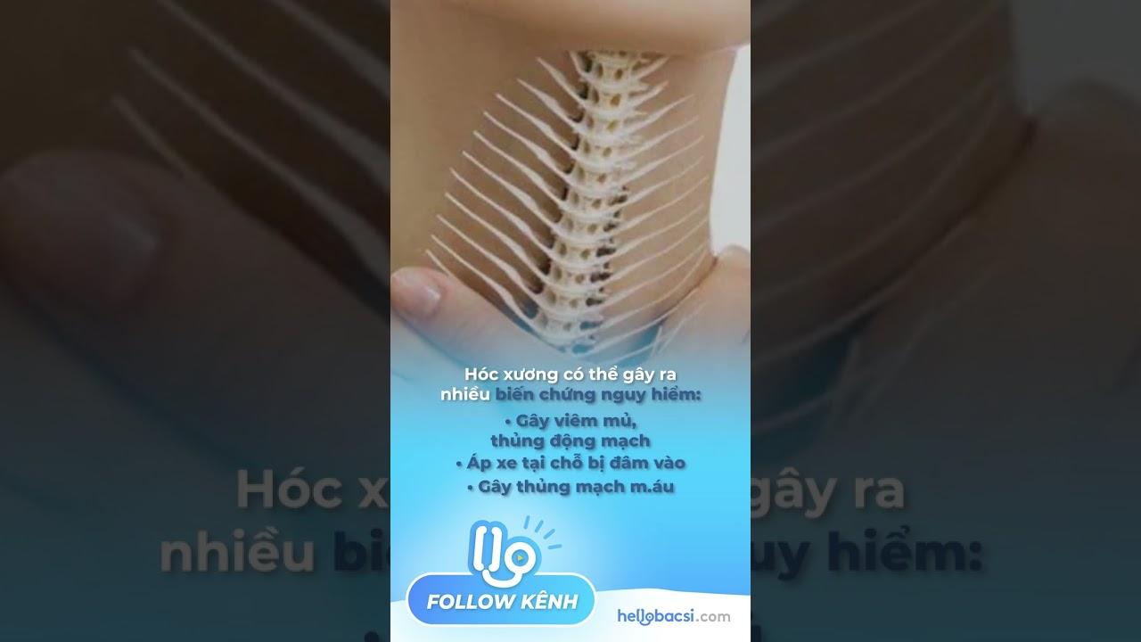 Ra mắt trợ lý sức khoẻ hello bacsi ai • Hello Bacsi